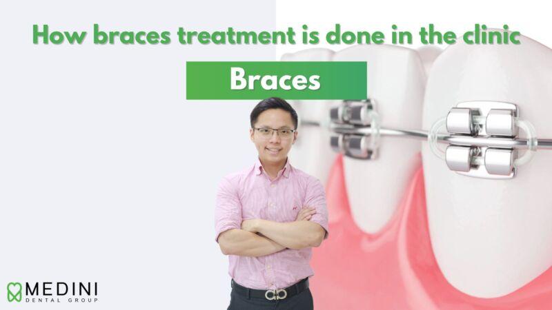 A brief explanation of how braces treatment is done in the clinic ...