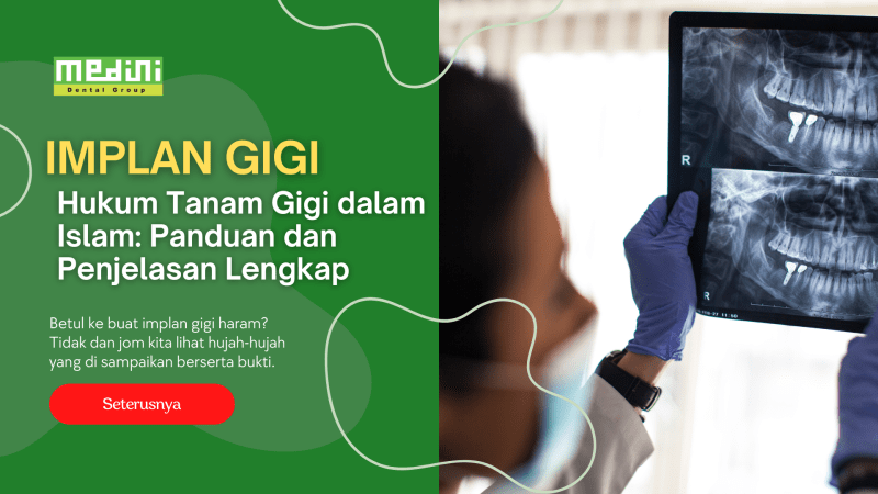 Hukum Tanam Gigi dalam Islam: Panduan dan Penjelasan Lengkap - MEDINI DENTAL GROUP | DENTAL ...